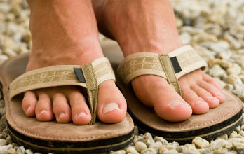 Tests and Exams for Tinea Pedis